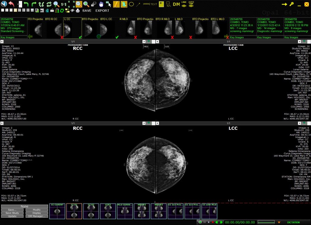 EXA Mammo - CMX Medical Imaging
