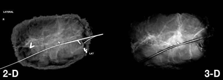 MOZART System - CMX Medical Imaging