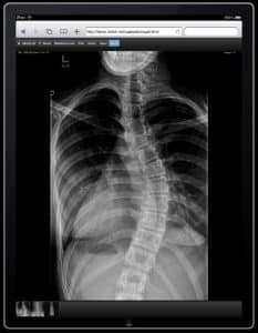 Opal-RAD - CMX Medical Imaging