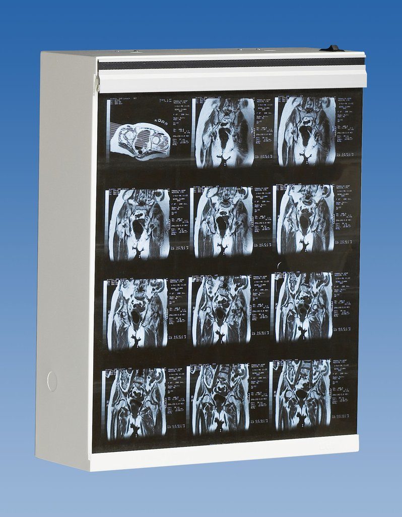 MG-7 Illuminators - CMX Medical Imaging